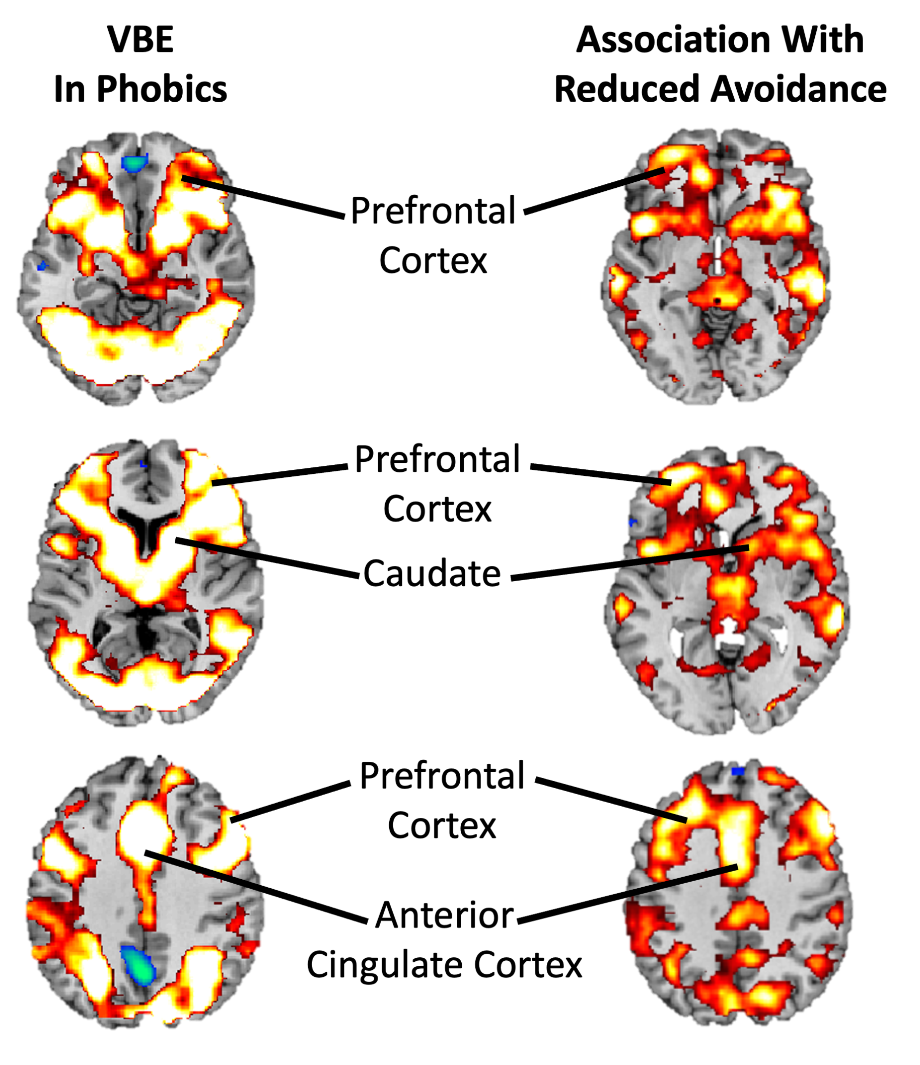 Professor Paul Siegel Awarded Third NIMH Grant • News • Purchase College